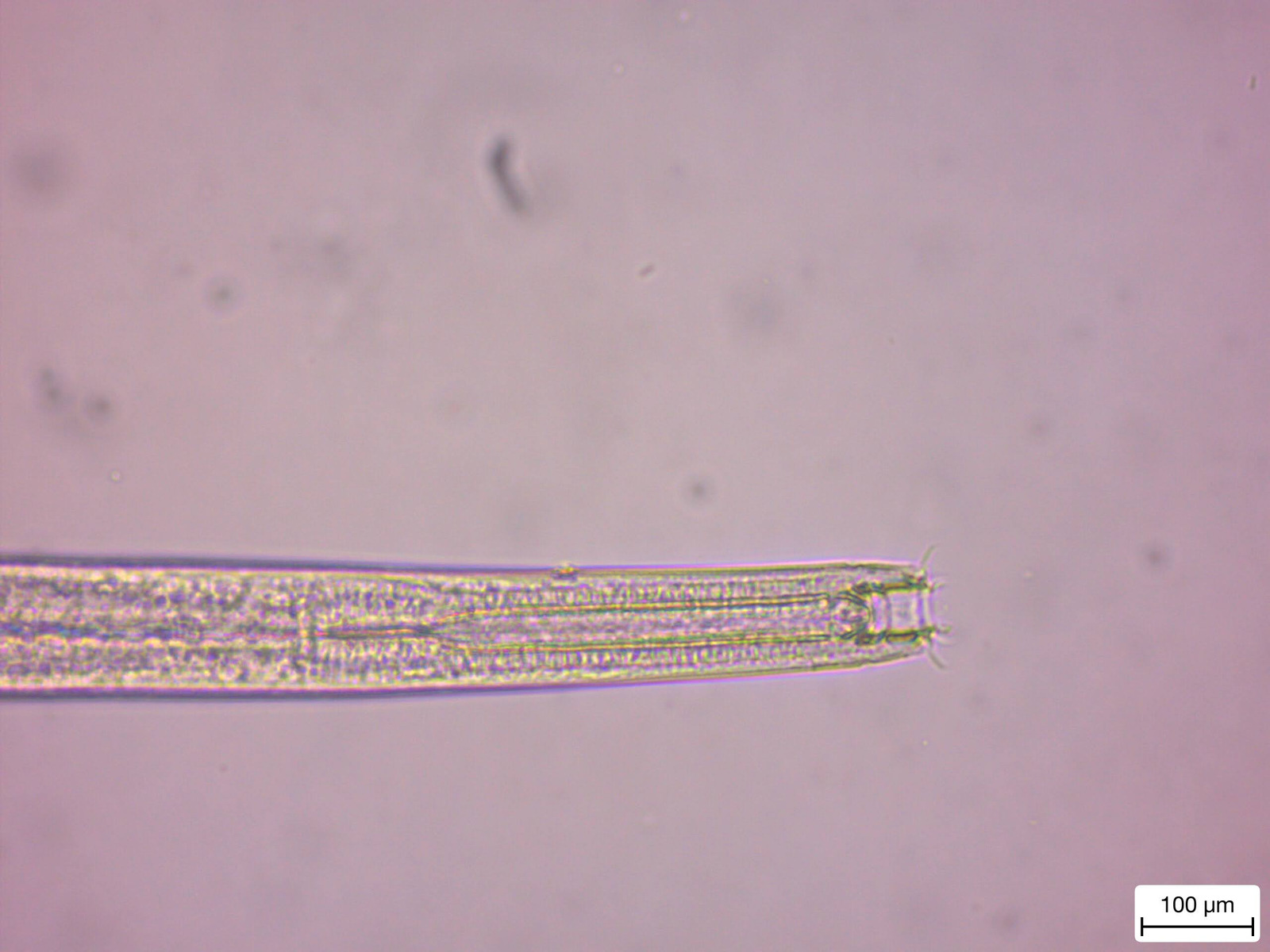 Bacteriovores: Diplogasteridae – nemlab
